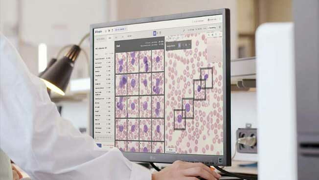 Beckman Coulter taps Scopio Labs to speed up blood smear analysis ...