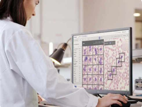 Beckman Coulter and Scopio Labs Add World's First Digital Bone Marrow Imaging and Analysis to ...