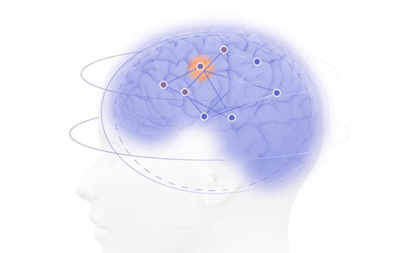 BRAIN.Q achieves CE mark for Its breakthrough therapy for reducing ...